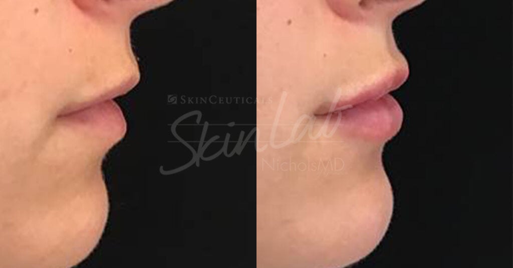 Before & Afters - SkinLab