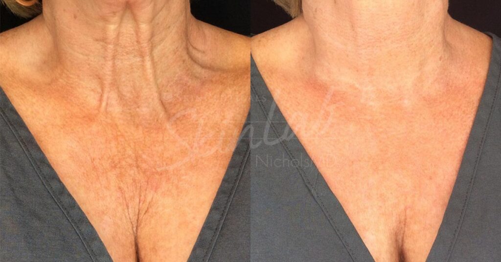 Before & Afters - SkinLab